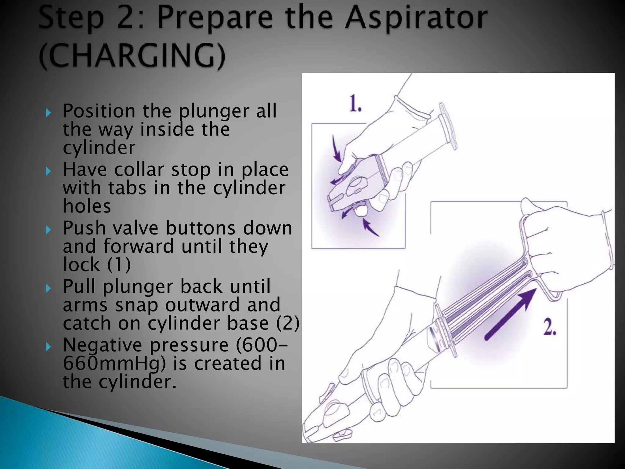 Manual vacuum aspiration | PPTX