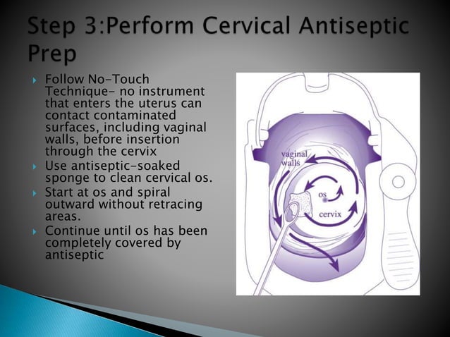 Manual vacuum aspiration | PPTX