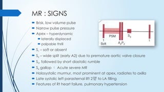 "Mitral Valve Disease: Pathophysiology, Diagnosis, and Treatment ...