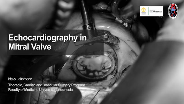 Echocardiography of Mitral Valve : Surgeons perspective | PPT | Free ...