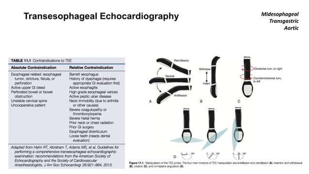 Echocardiography of Mitral Valve : Surgeons perspective | PPT | Free ...