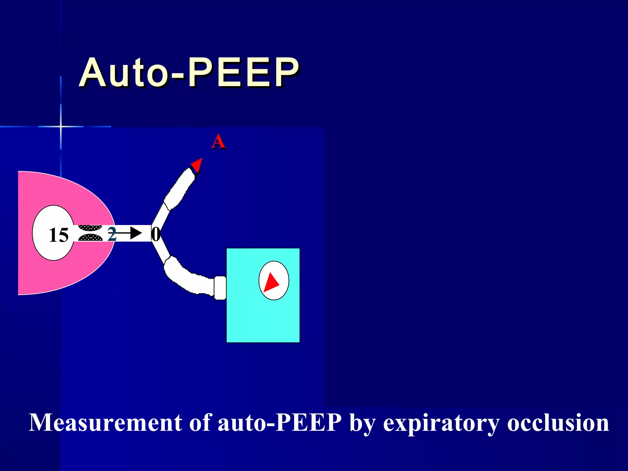 Mechanical ventilation in air flow obstruction | PPT