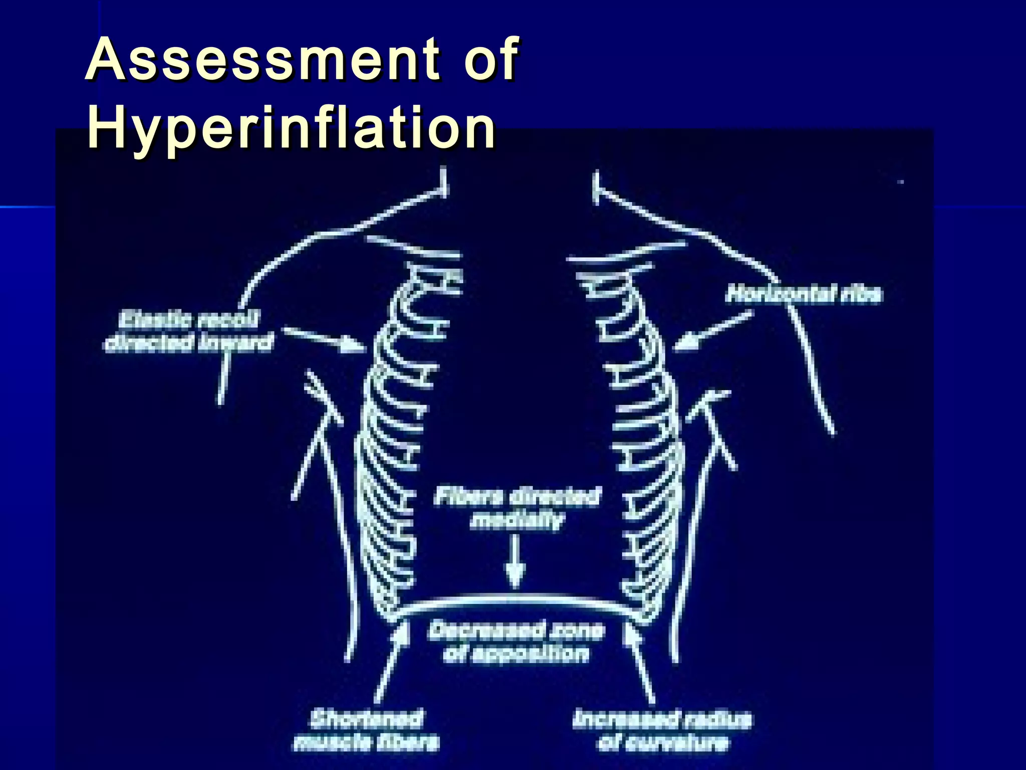 Mechanical ventilation in air flow obstruction | PPT