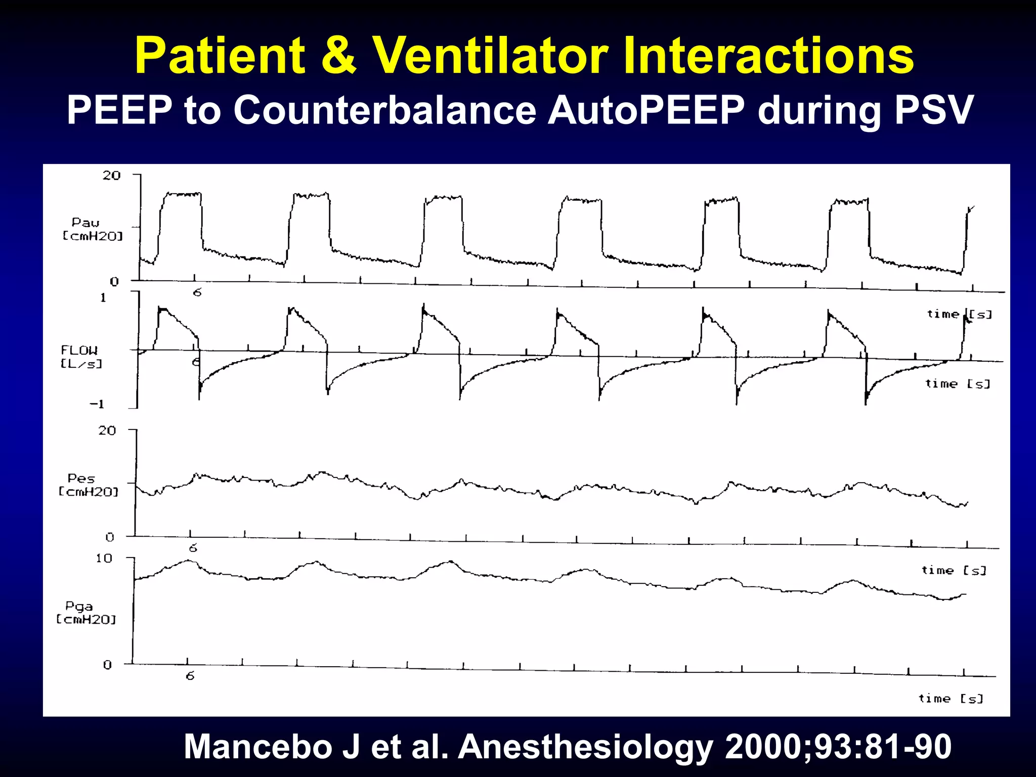Mechanical Ventilation in COPD Venti Cairo | PDF