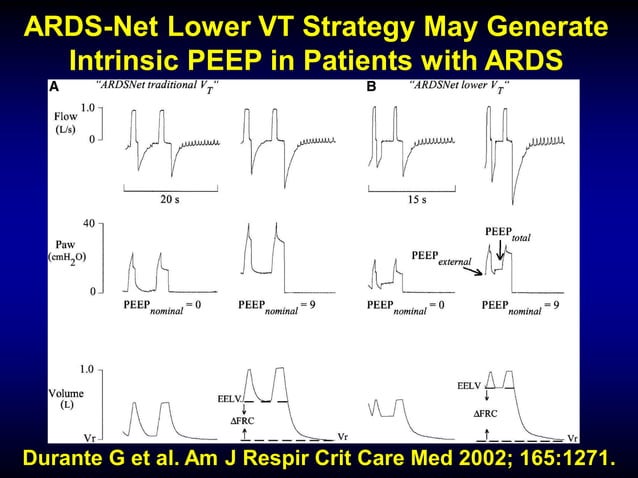 Mechanical Ventilation in COPD Venti Cairo | PDF | Lung and Respiratory ...