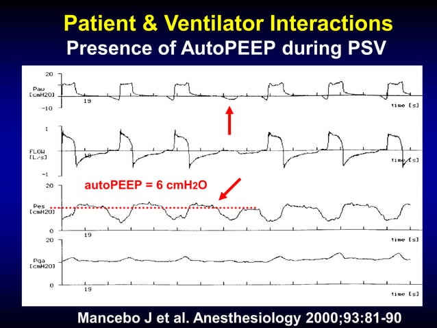 Mechanical Ventilation in COPD Venti Cairo | PDF | Lung and Respiratory Health | Diseases and ...