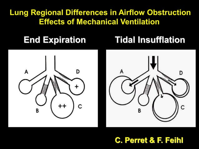 Mechanical Ventilation in COPD Venti Cairo | PDF | Lung and Respiratory Health | Diseases and ...