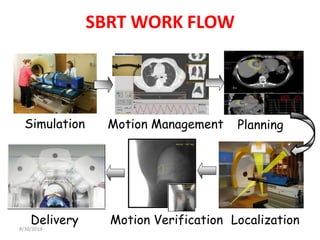 SBRT LIVER SIMULATION | PPTX