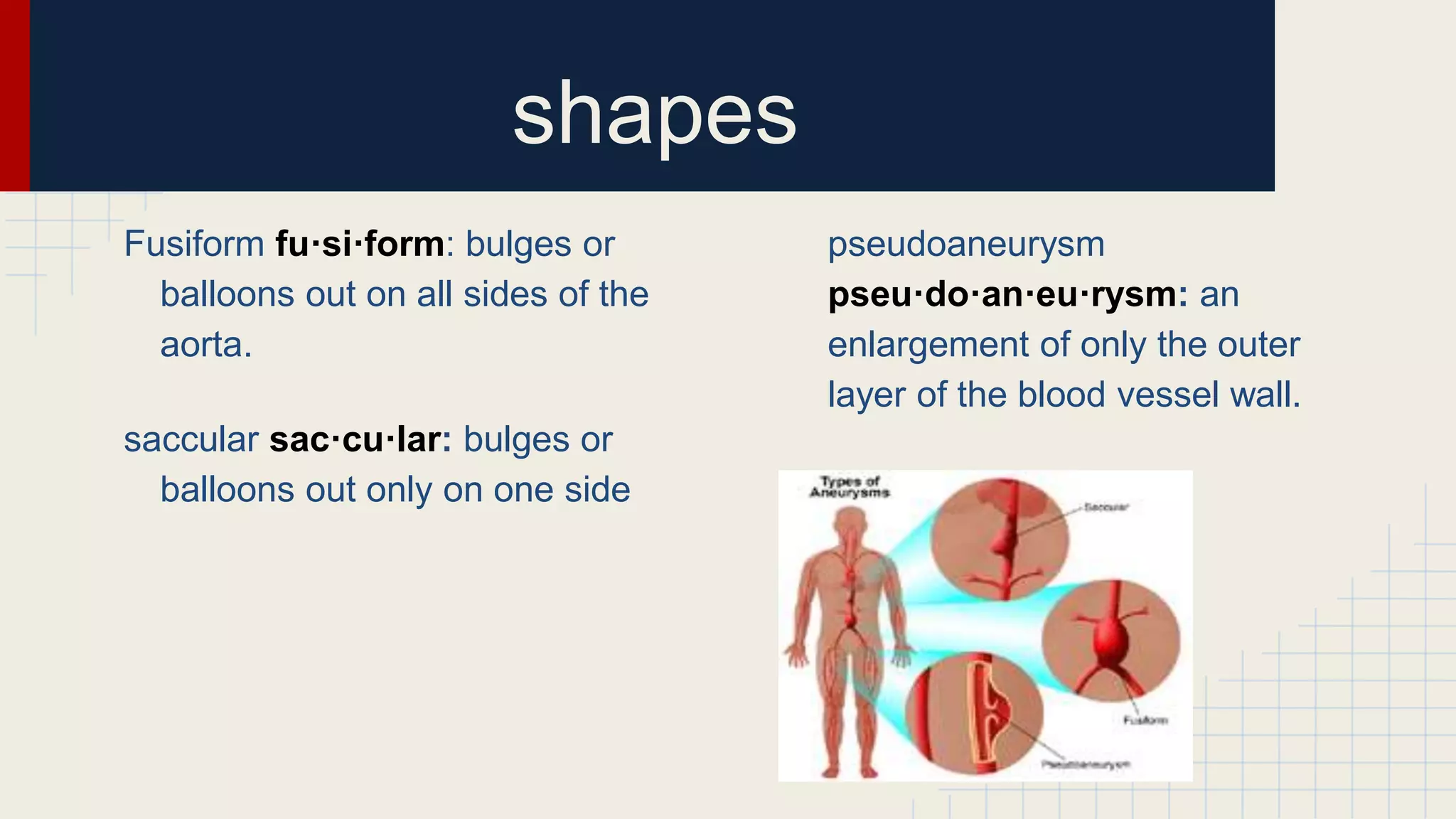 Thoracic aortic aneurysm | PPTX