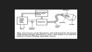 Microwave Diathermy (MWD) - Explained.pptx