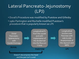 Management of Chronic Pancreatitis | PPS
