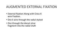Mx of distal radius fractures | PPT