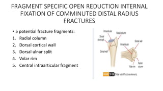 Mx of distal radius fractures | PPTX
