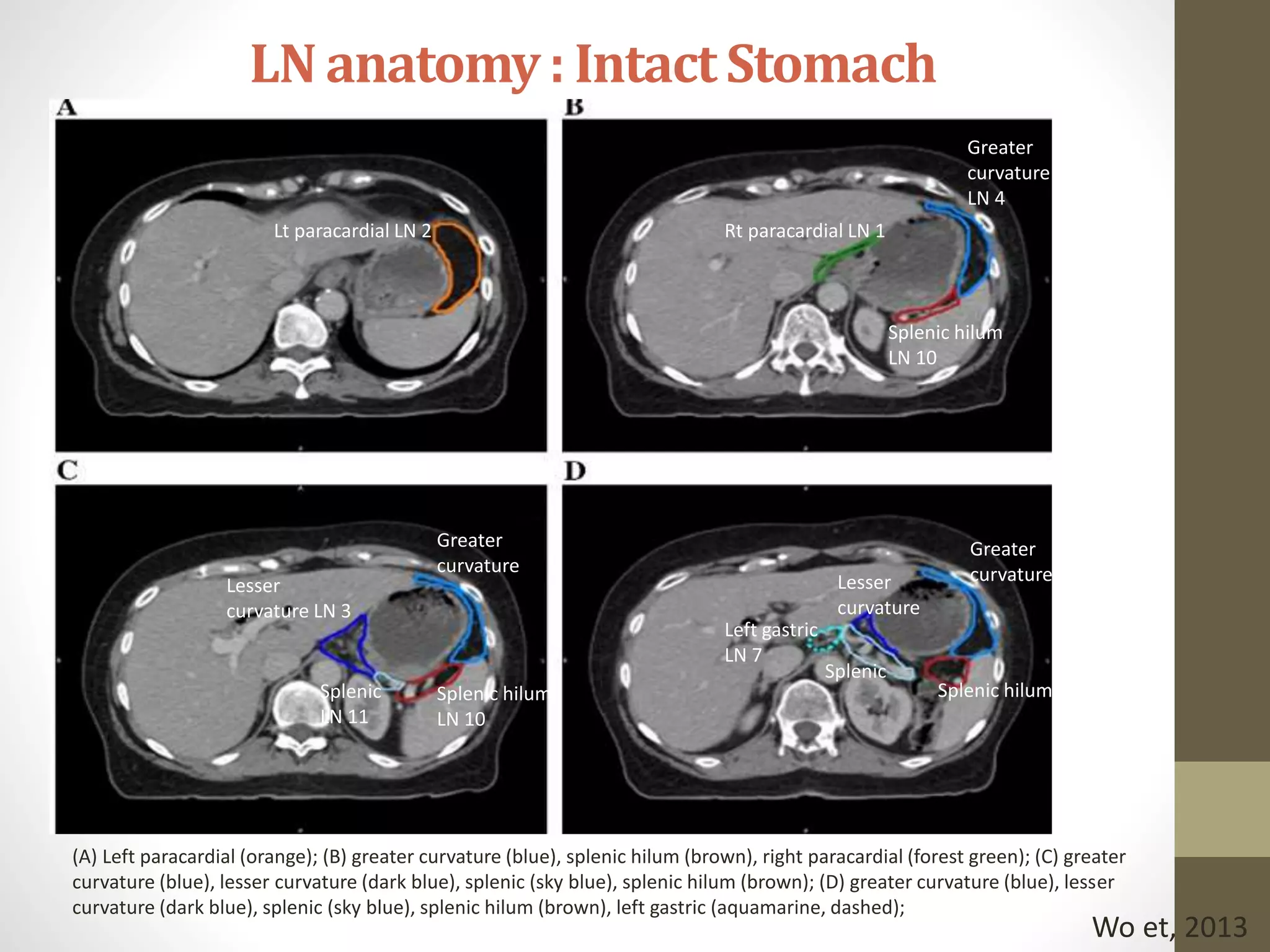 Management of gastric cancer | PPTX