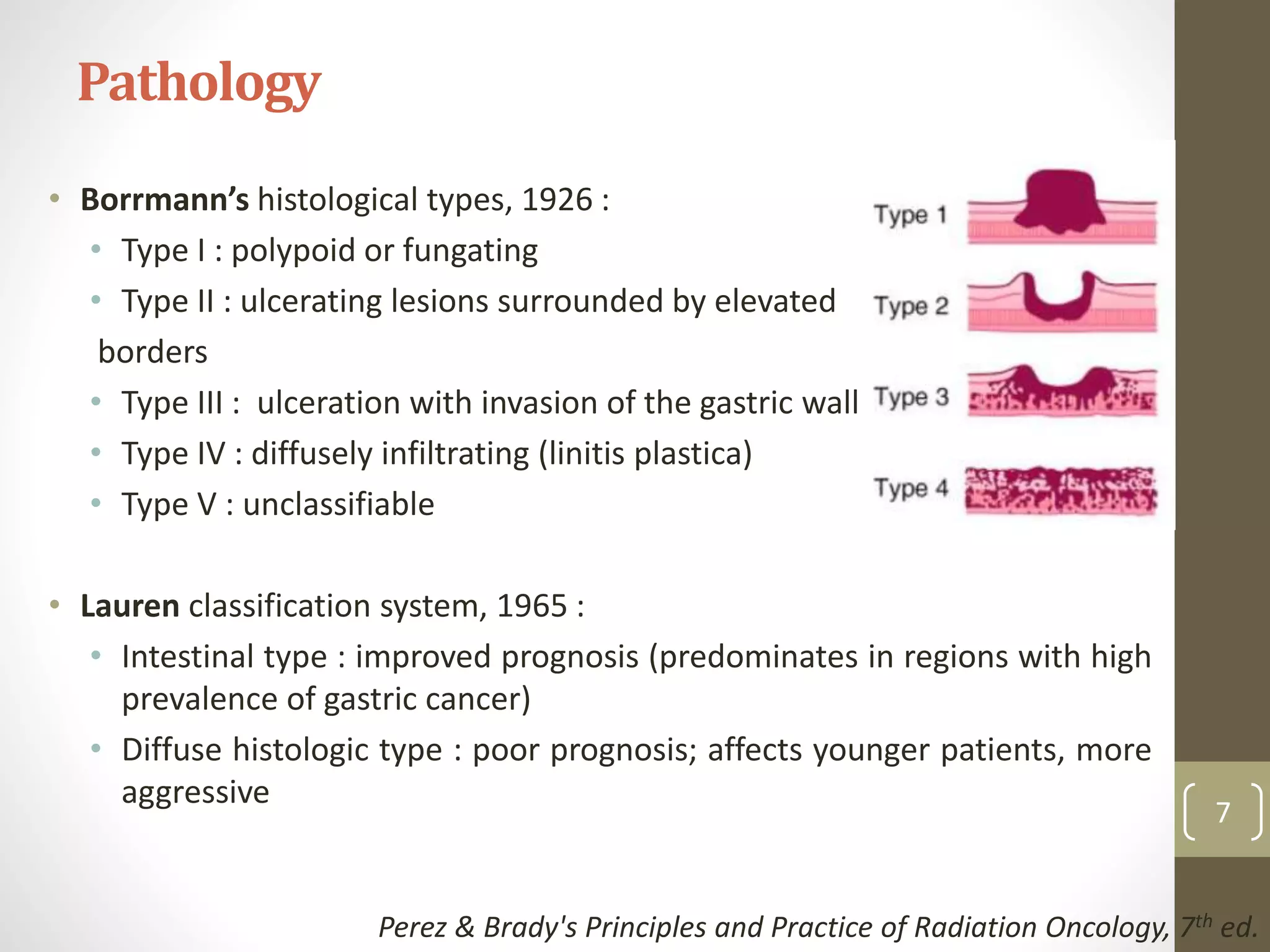 Management of gastric cancer | PPTX