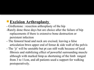Management of Osteoarthritis | PPT