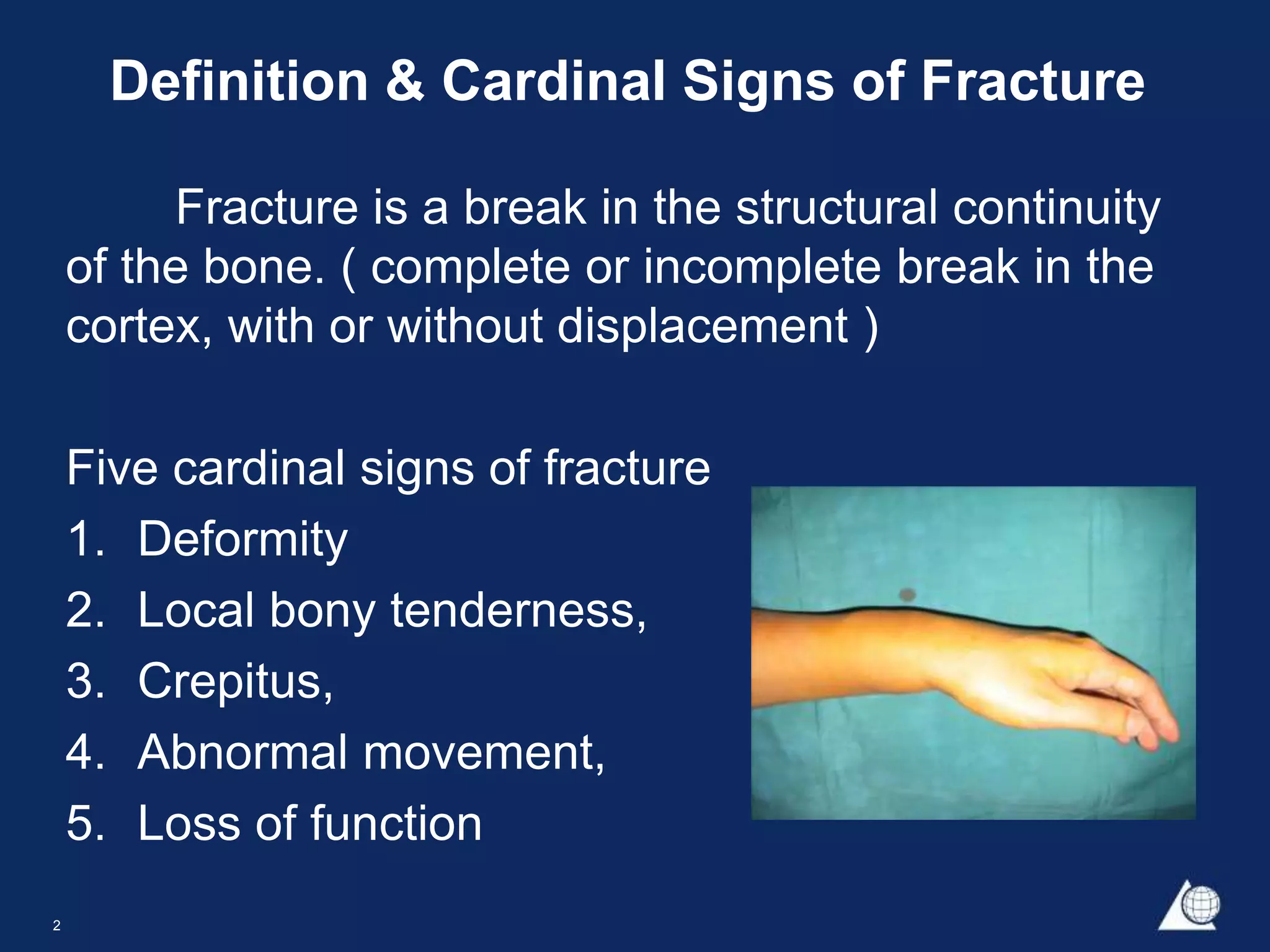 Mx of Open fracture ( FP 2 teaching ).ppt