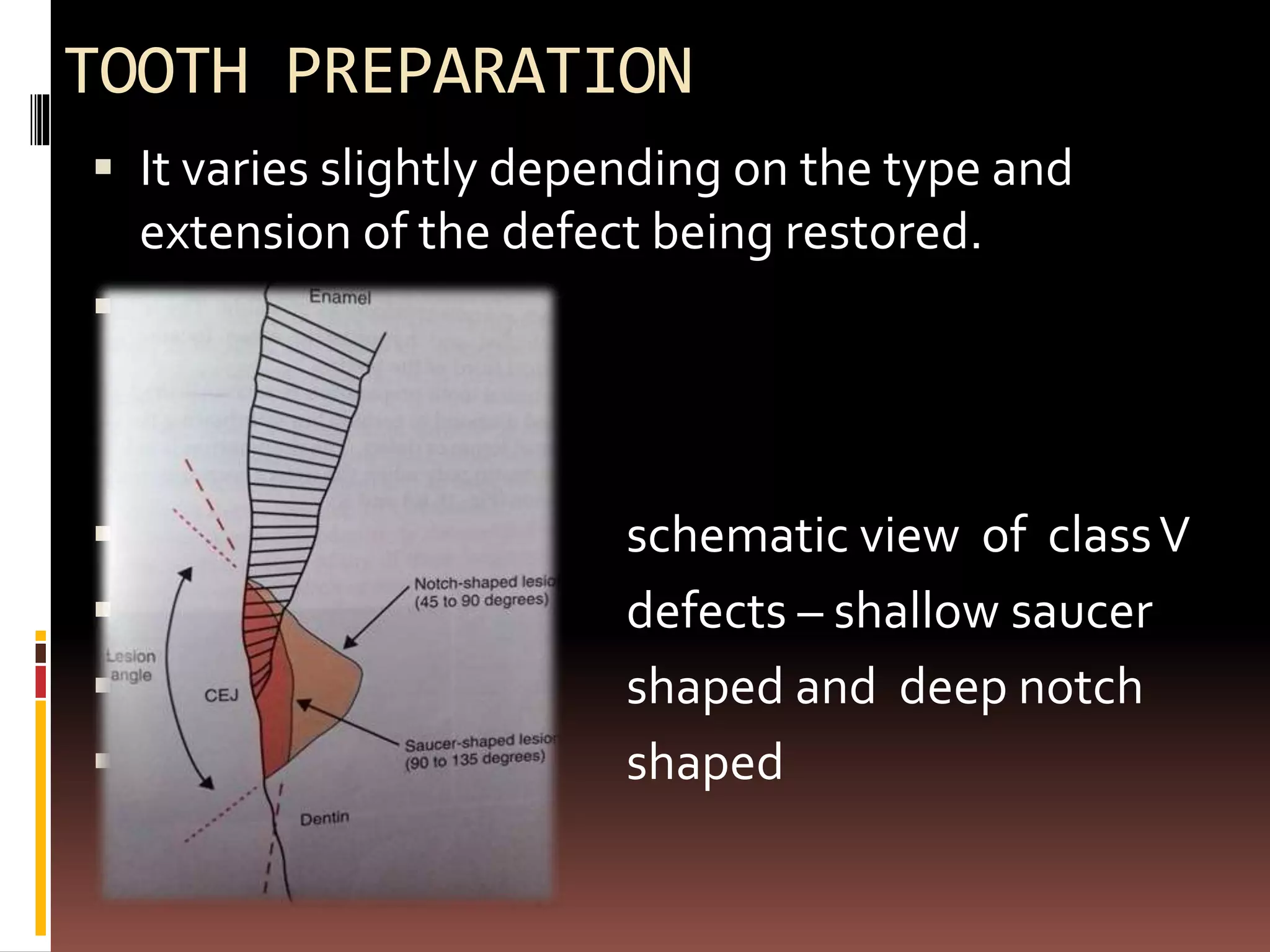 Management of class V caries | PPTX