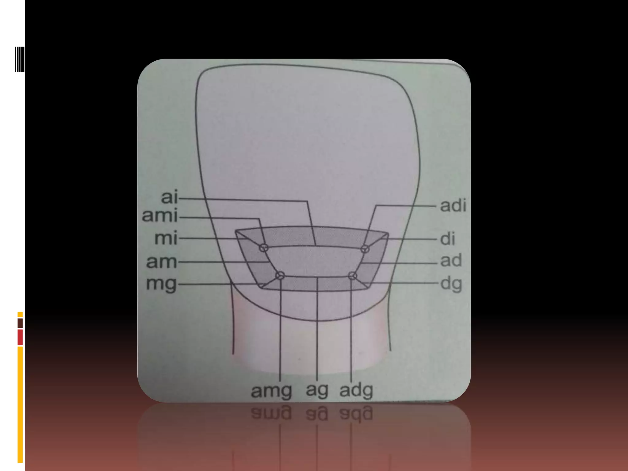 Management of class V caries | PPTX