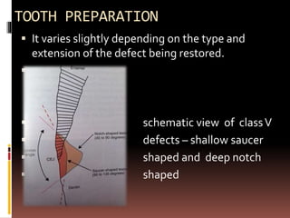 Management of class V caries | PPTX