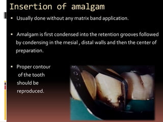 Management of class V caries | PPTX