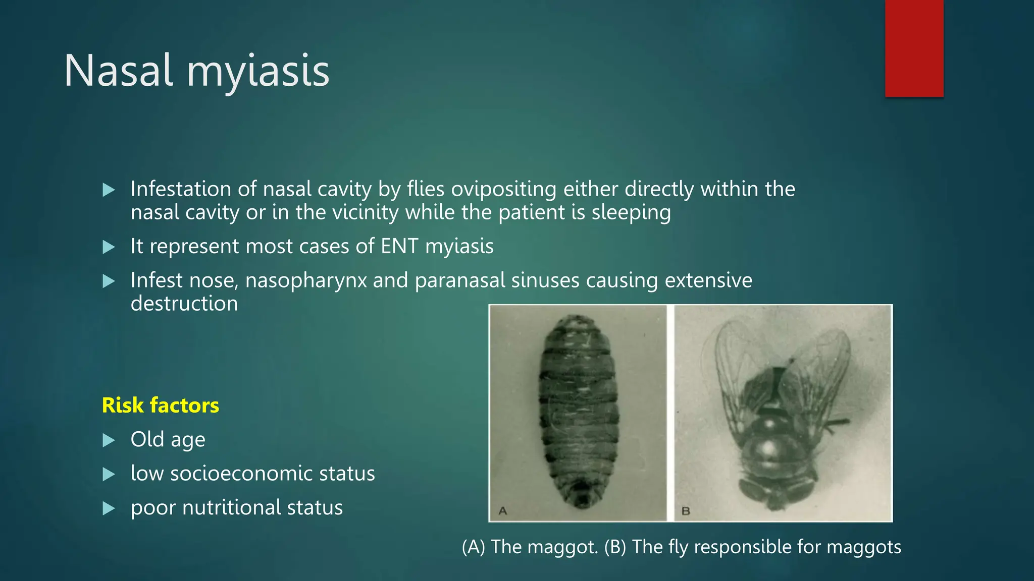 Myiasis in Ear Nose Throat and HNS .pptx