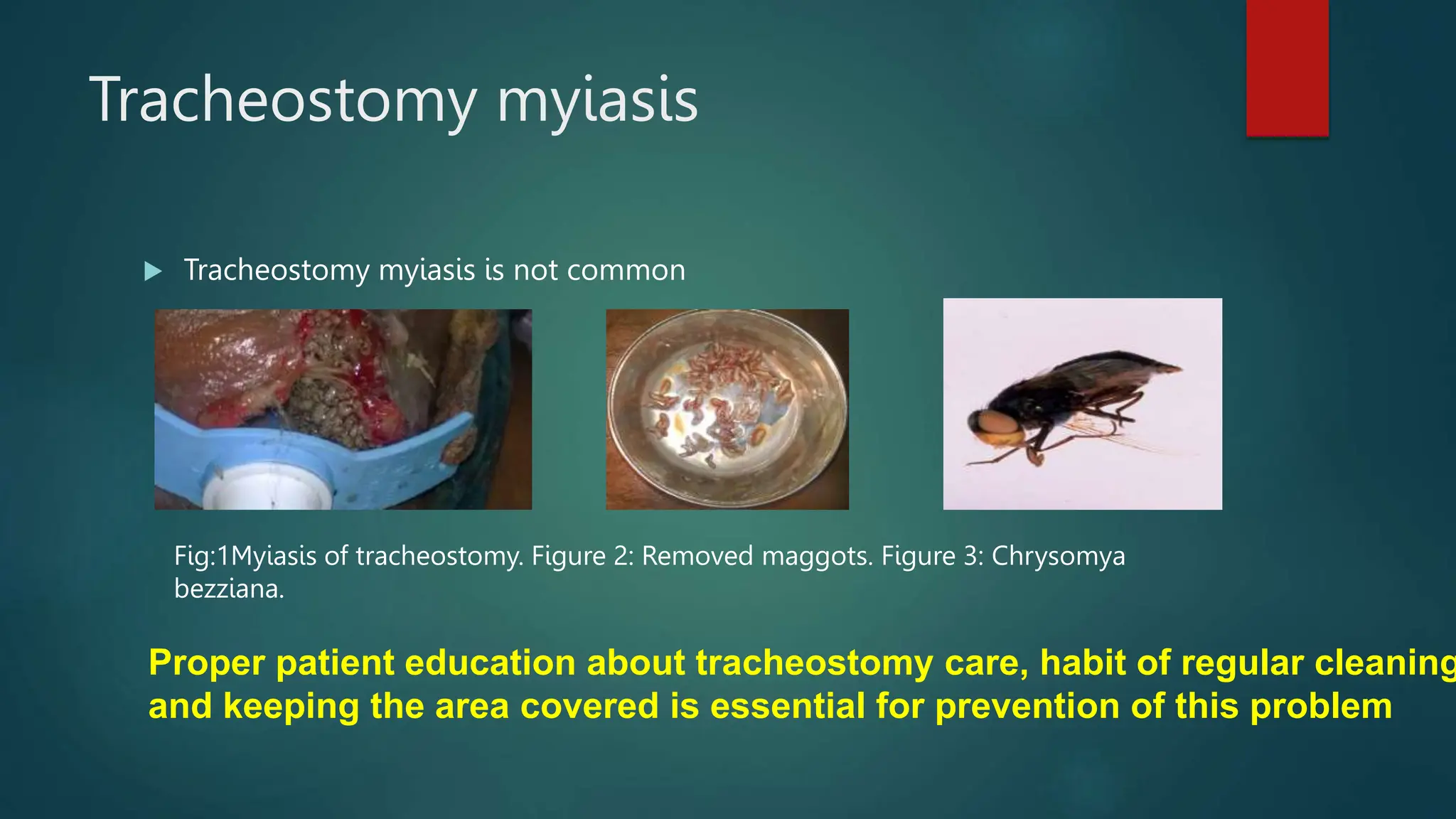 Myiasis in Ear Nose Throat and HNS .pptx