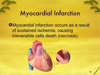Coronary Artery Disease and Acute Coronary Syndrome | PPT