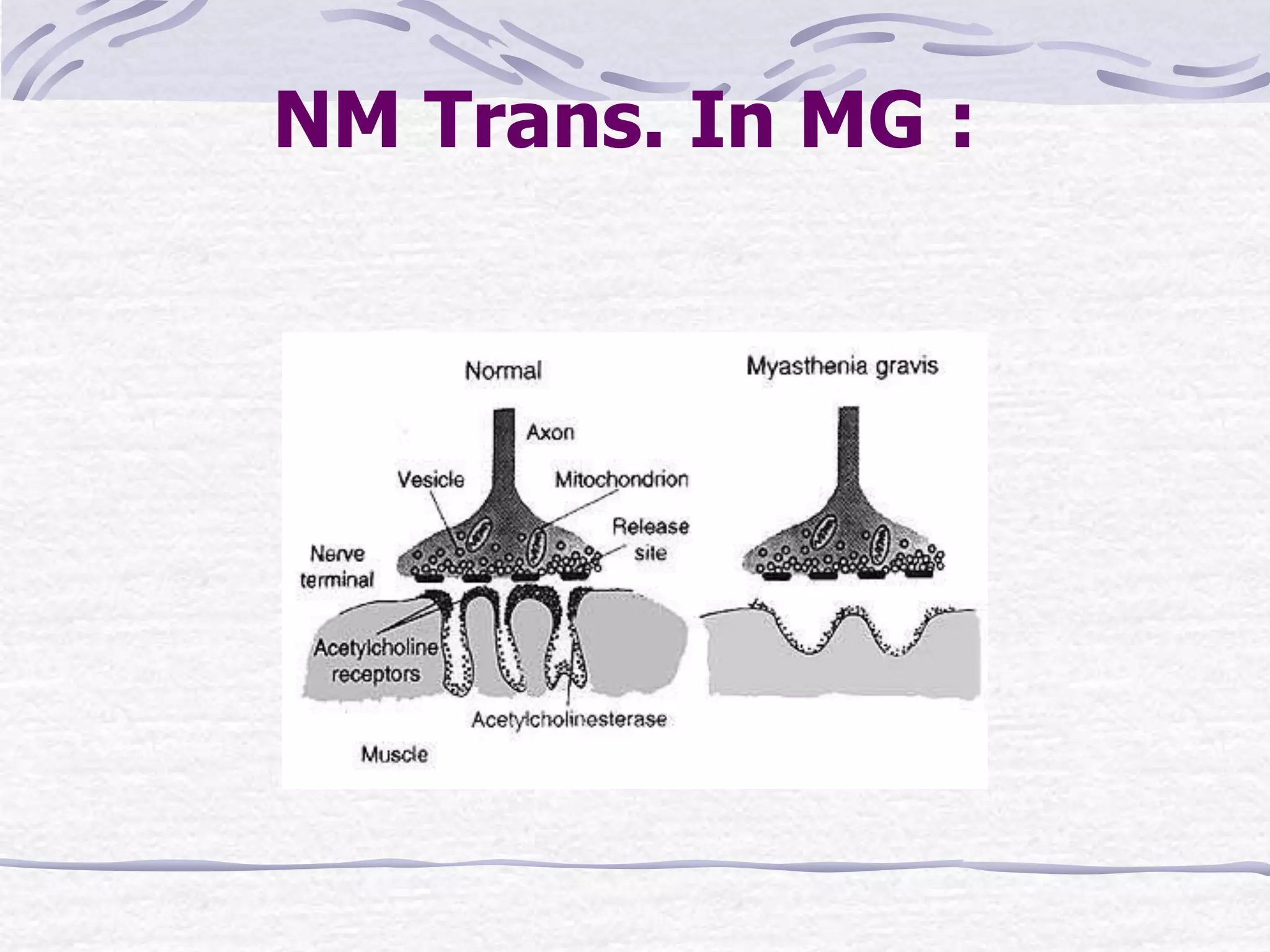 Myasthenia gravis ppt immunology | PPTX