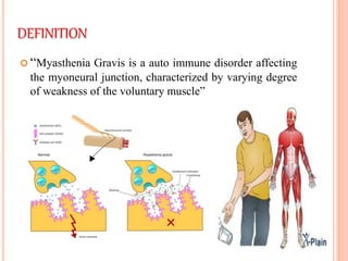 Myasthenia gravis | PPTX