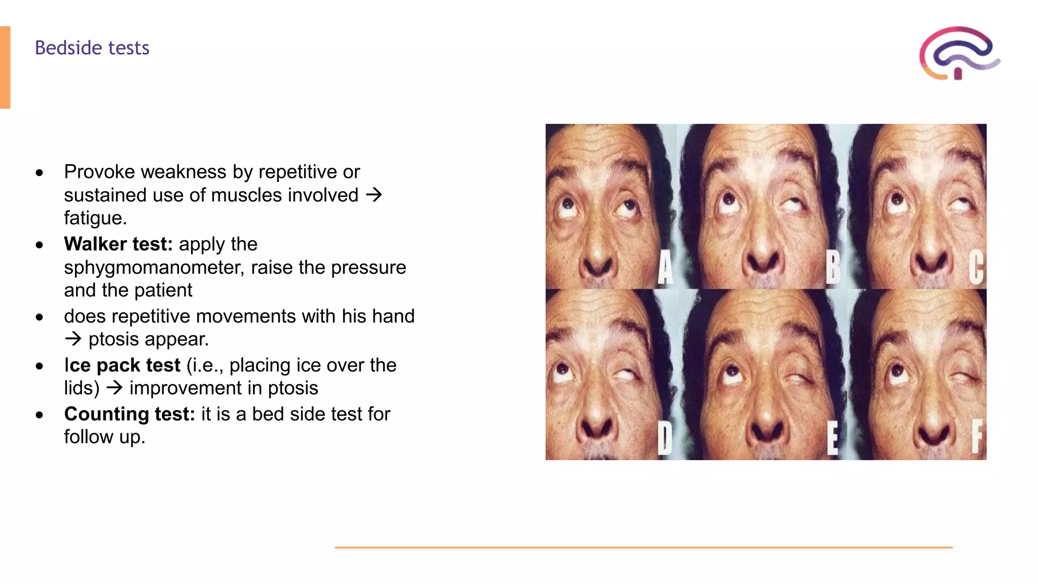 Myasthenia gravis | PPTX
