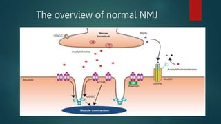 Myasthenia Gravis.pptx | Free Download