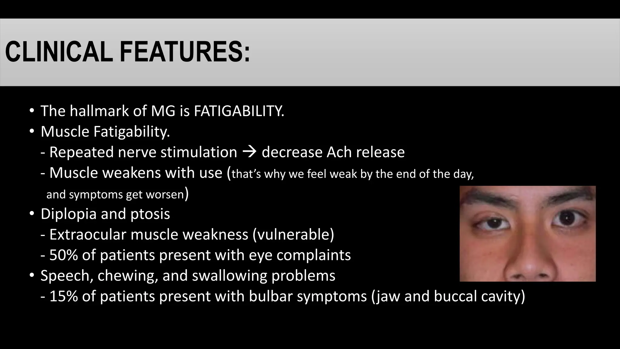 MYASTHENIA GRAVIS - by Shanmukh Tunuguntla | PPTX