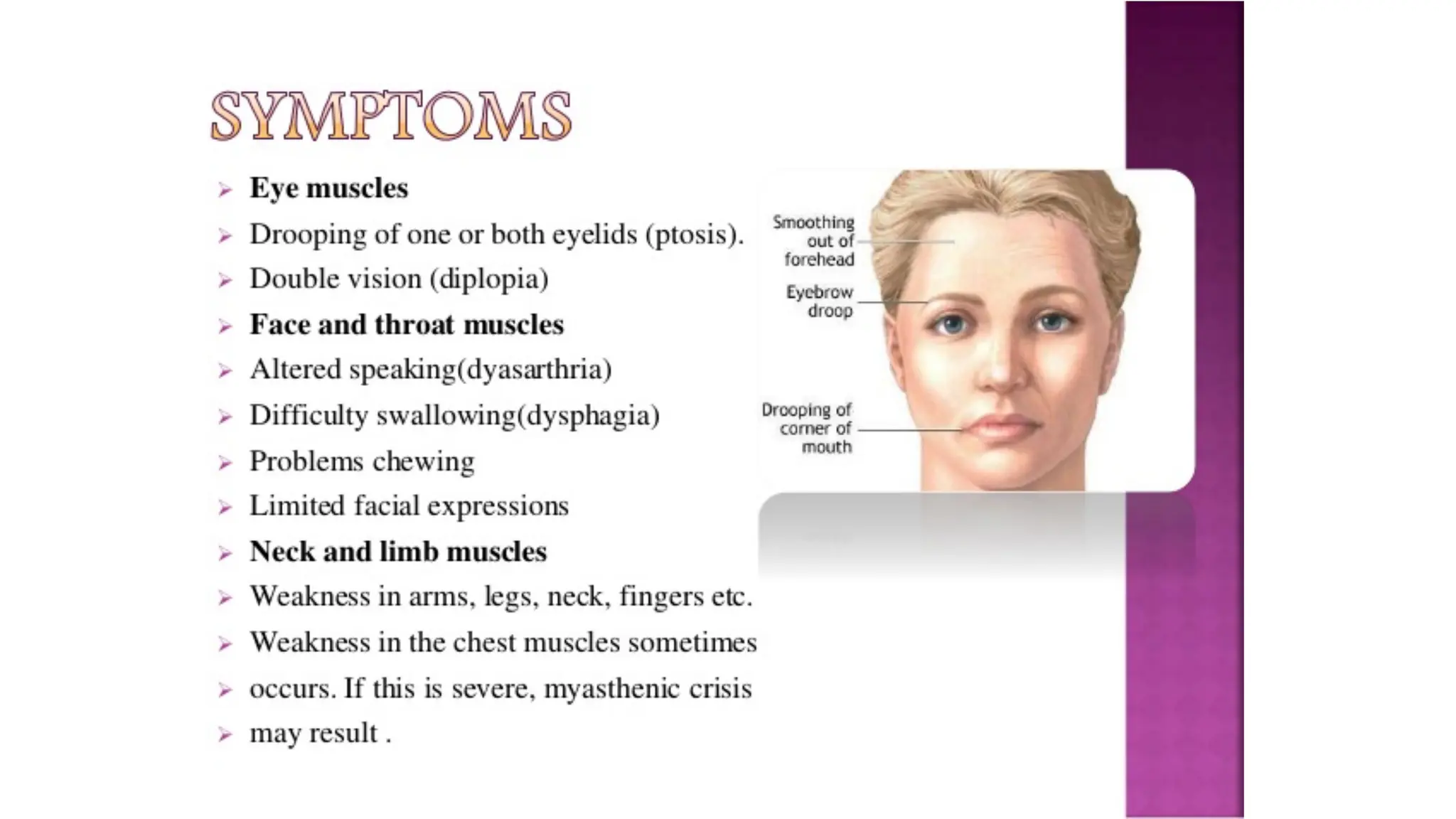 MYASTHENIA GRAVIS its a disease of NMJ of nerve to Muscle | PDF | Eye ...