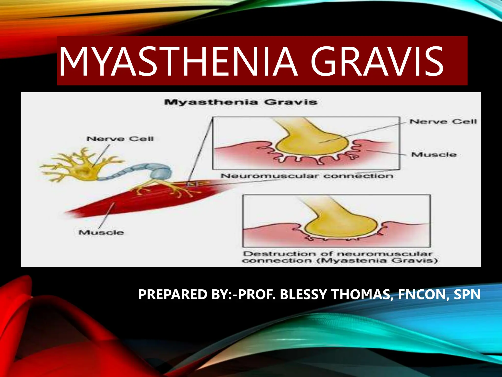 MYASTHENIA GRAVIS POWER POINT PRESENTATION | PPTX