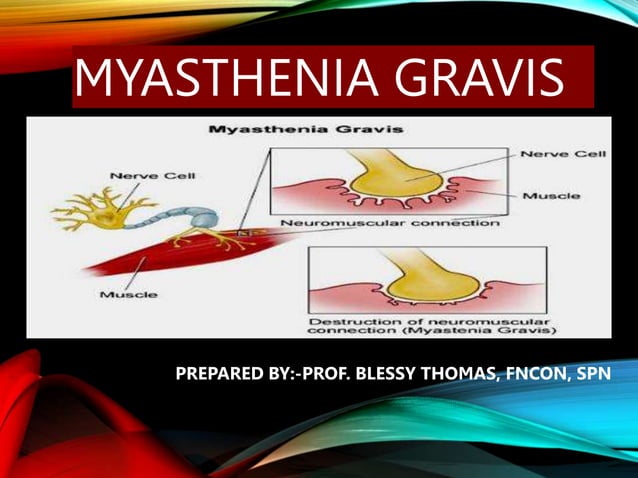MYASTHENIA GRAVIS POWER POINT PRESENTATION | PPTX