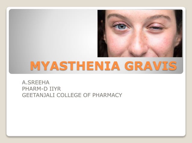 MYASTHENIA GRAVIS: etiology, pathophysiology, clinical manifestations ...