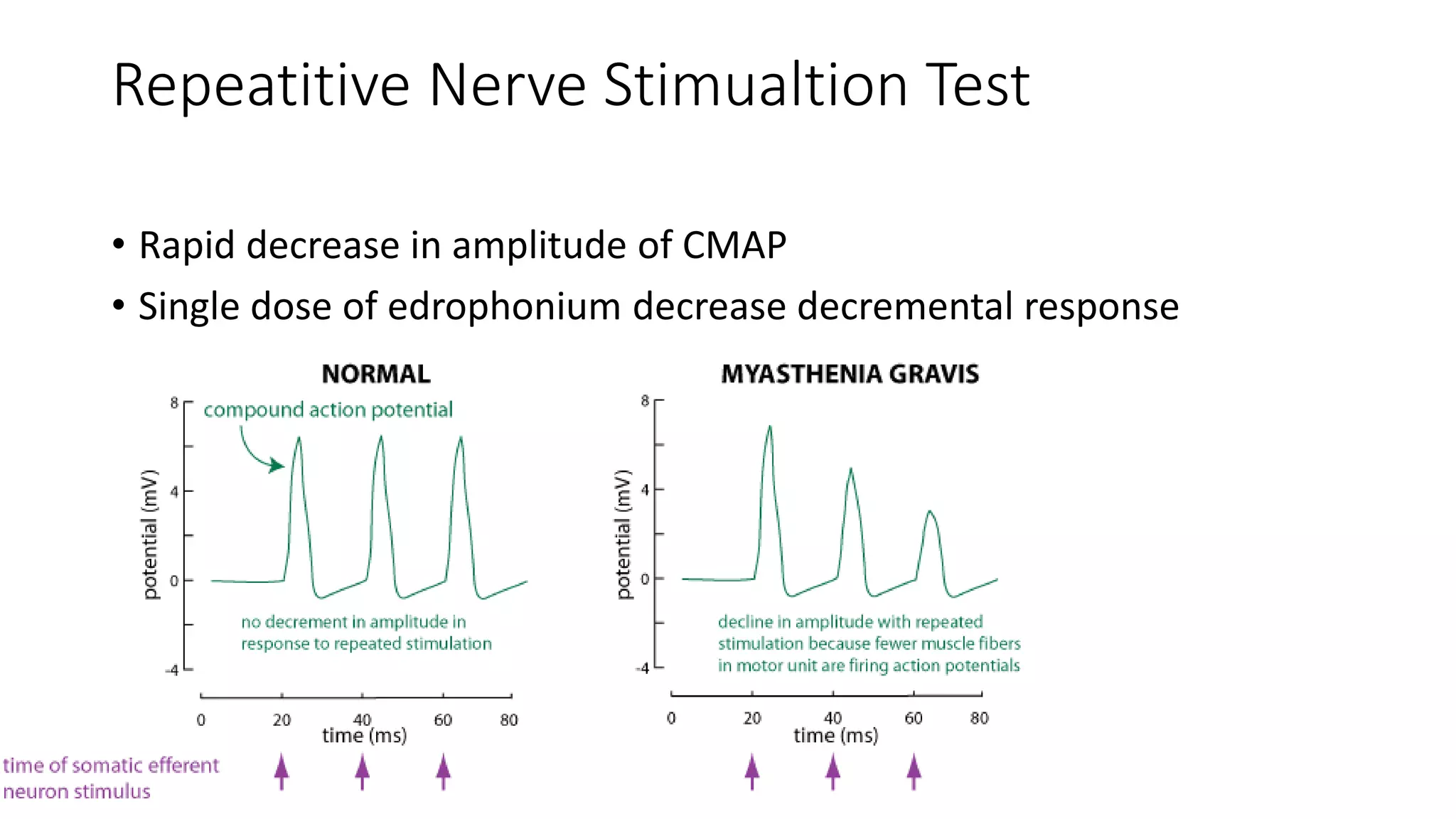 Myasthenia gravis and anaesthesia | PPTX