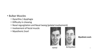 Myasthenia gravis and anaesthesia | PPTX