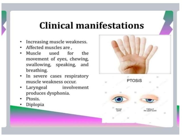 myasthenia gravis and lambert eaton syndrome.pptx | Diseases and Conditions | Medical Health