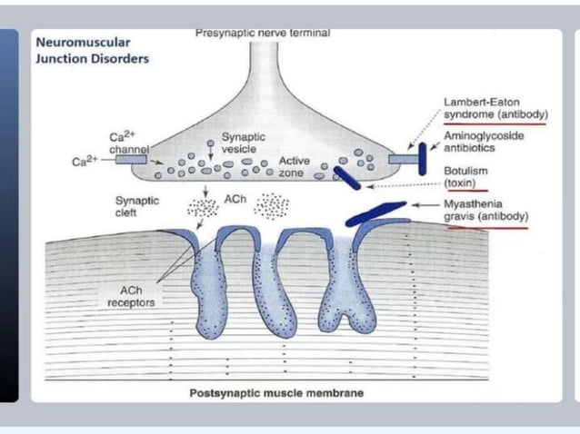 myasthenia gravis and lambert eaton syndrome.pptx | Diseases and Conditions | Medical Health