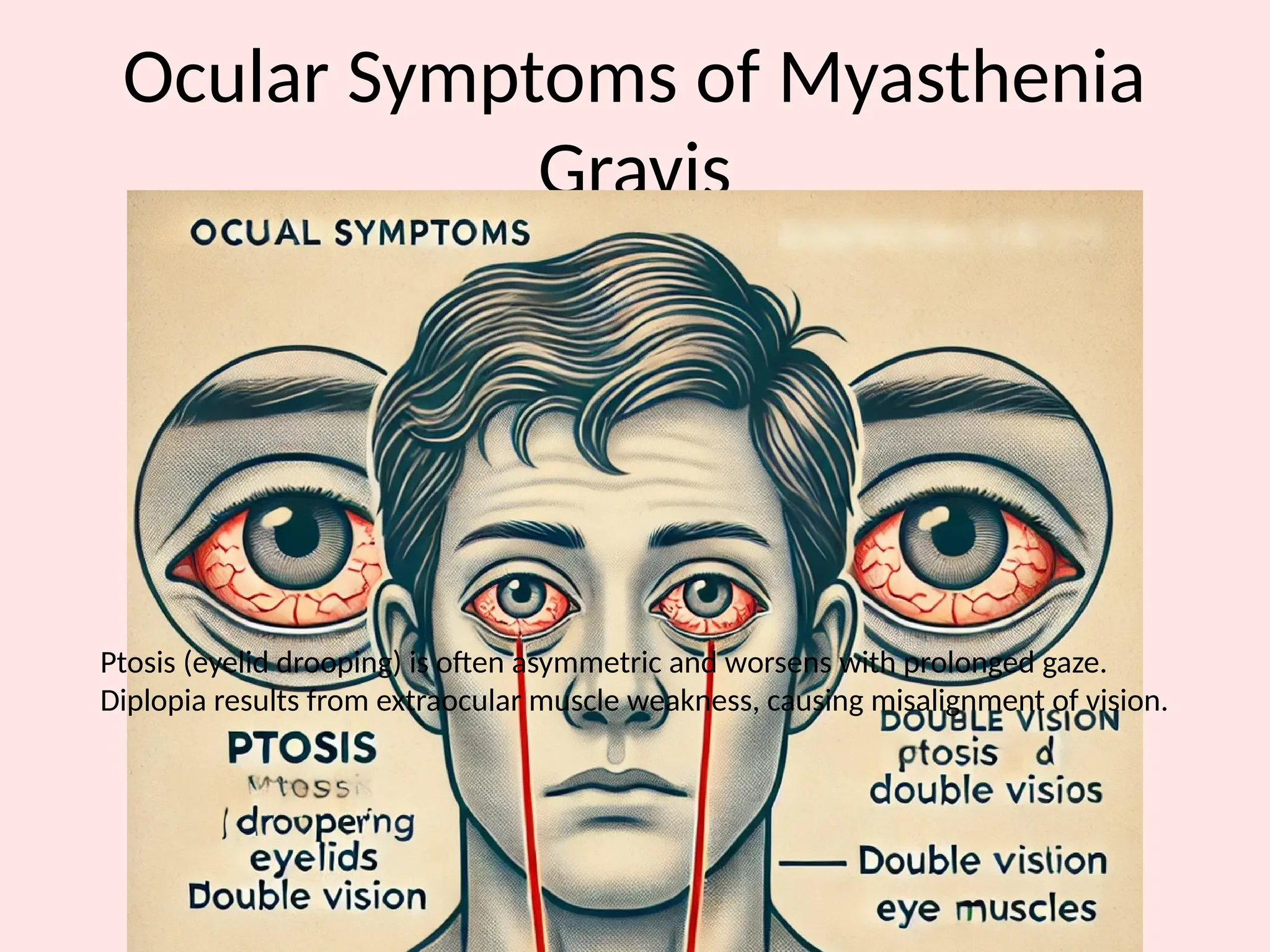 Myasthenia_Gravis_Detailed_Presentation by sugandha.pptx by sugandha.pptx