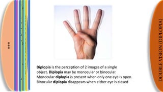 Myasthenia gravis | PPT