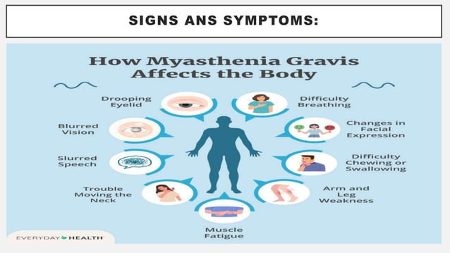 Myasthenia Gravis G.Hemaharshini.pptxnnn | PPT