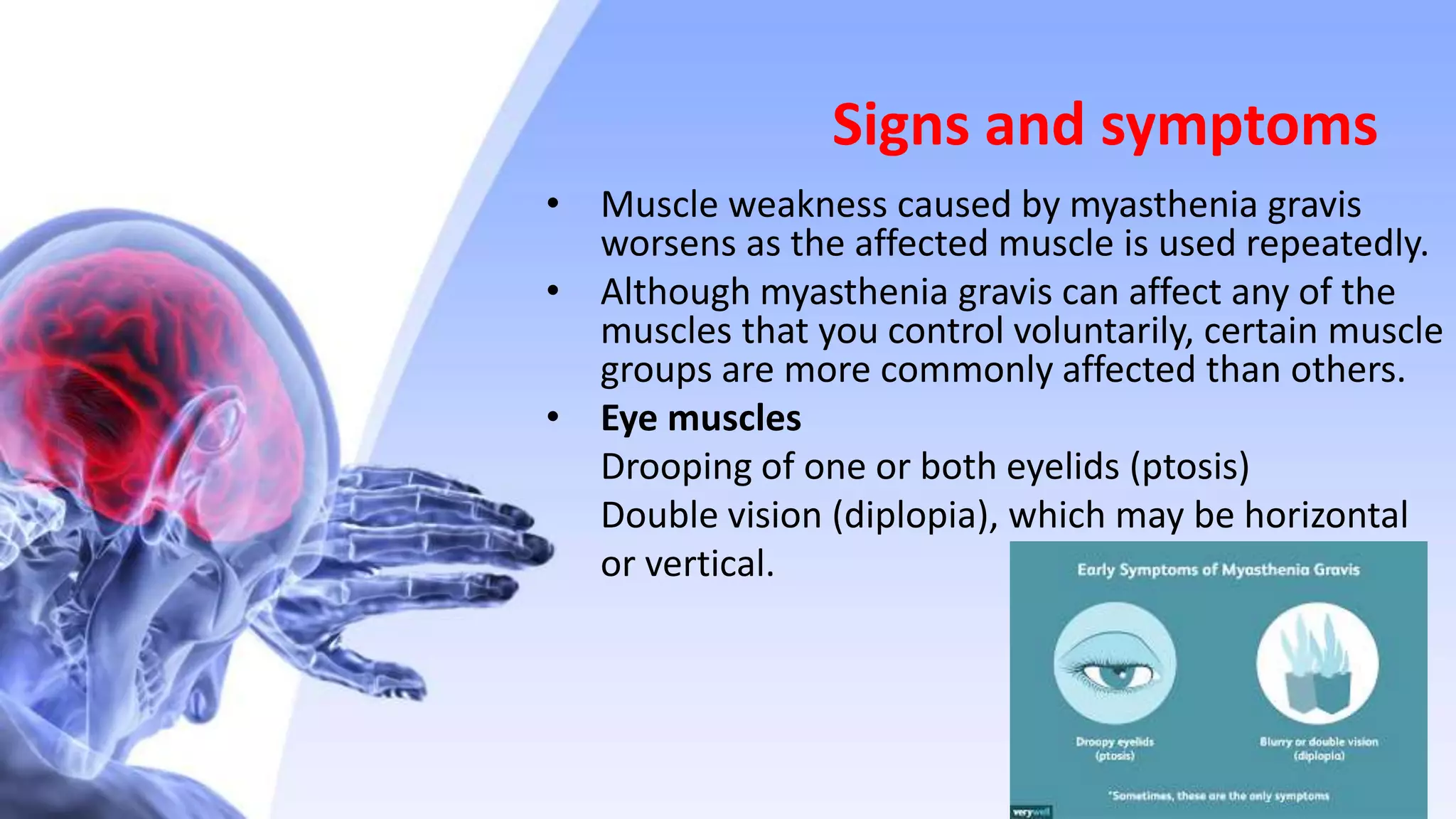 myasthenia gravis ppt.pptx