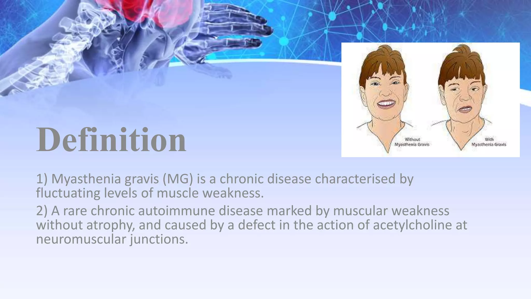 myasthenia gravis ppt.pptx