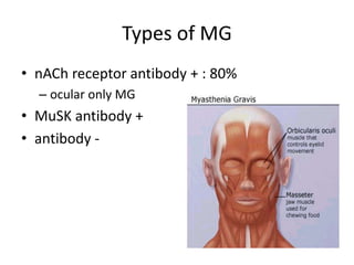 Pathophysiology: Myasthenia Gravis & Restless Leg Syndrome | PPTX