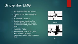 Myasthenia gravis sh | PPTX