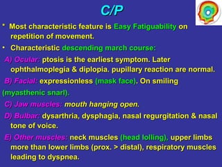 Myasthenia gravis Walid Reda Ashour | PPT