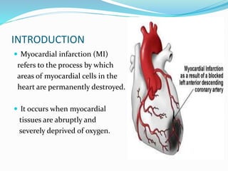 Mycardial infraction.ppt